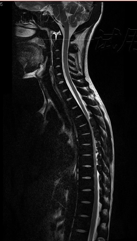 chaddock征,kerg征,oeim征_大山谷图库