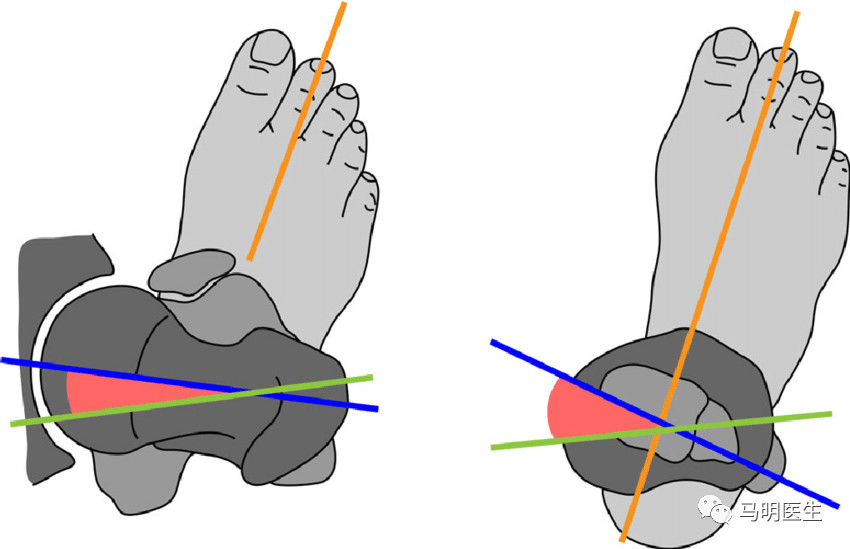 nelaton氏线-千图网